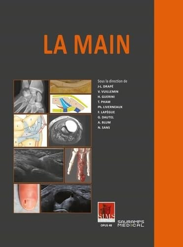 La main : poignet traumatique et microtraumatique, ligaments du poignet ...